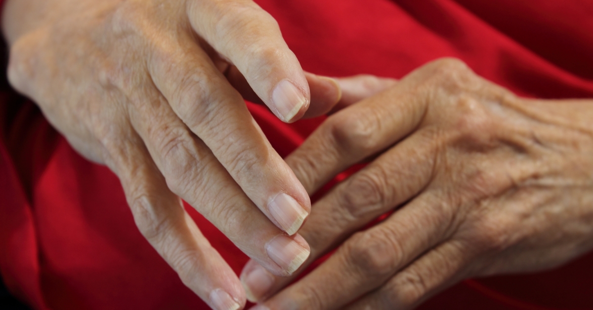 Frailty, Not Age, Best Predicted Recovery from Trauma | RxWiki