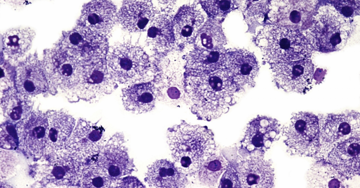 Brain Eating Monster | RxWiki