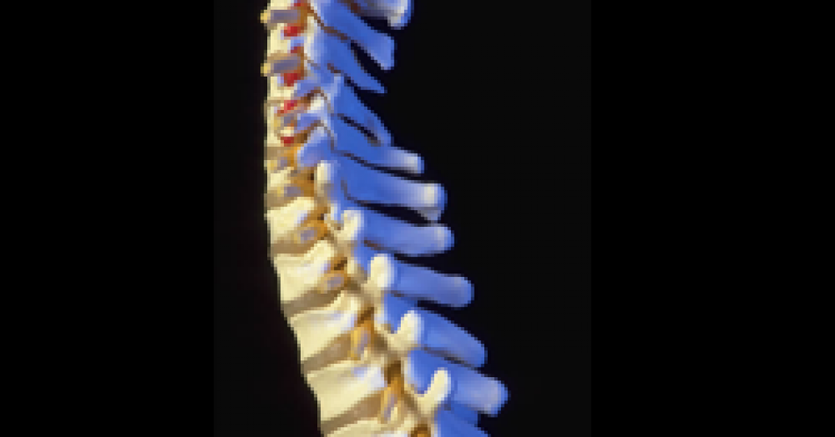 Multiple Sclerosis - Tricky, Unpredictable, Incurable | RxWiki