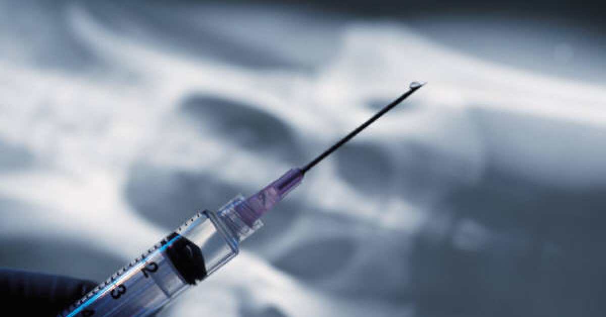 Dye Damages Women's Kidneys | RxWiki