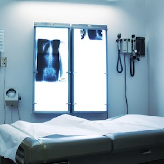 7 Tips for Treating COPD: Surgery | RxWiki